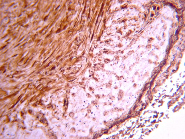 Anti-Procollagen Type III PIIINP Antibody | AB764P